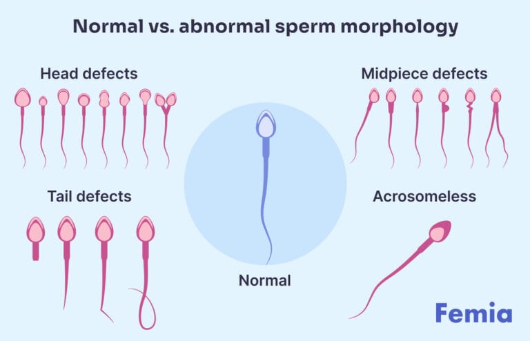 How to get pregnant with poor sperm morphology? - Femia Health