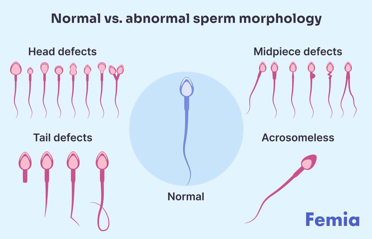 How to get pregnant with poor sperm morphology? - Femia Health