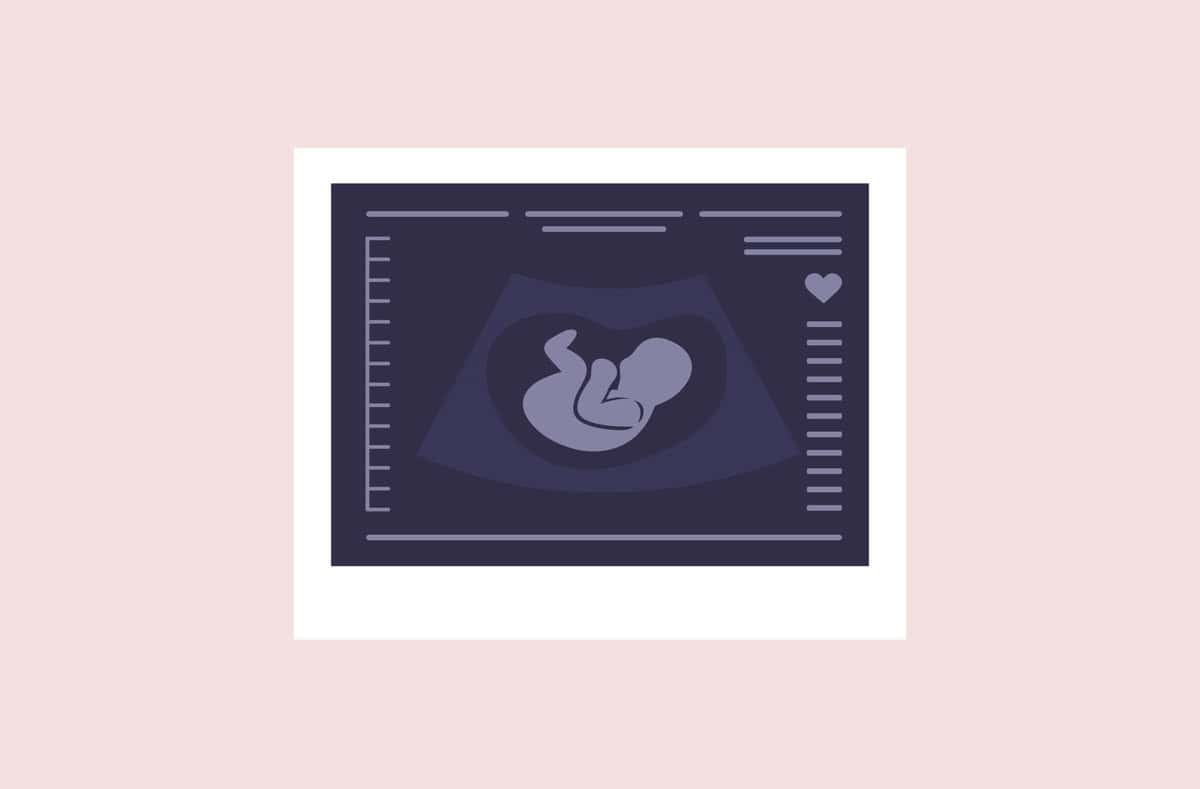 Down Syndrome Ultrasound vs Normal: Signs to Look For | Femia